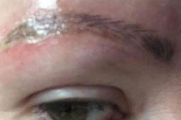 Melbourne salon sues for $150k after woman posts photos of eyebrow ...
