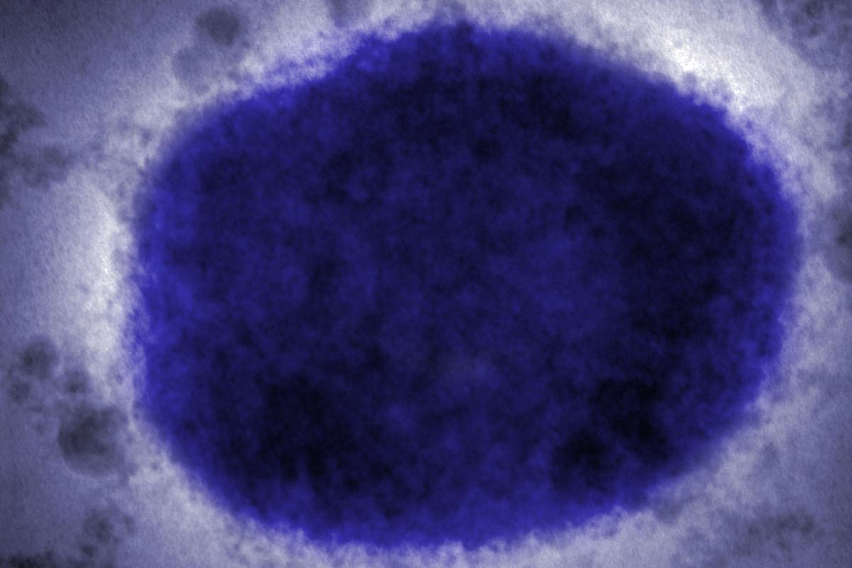 Monkeypox: what is it, and should we be worried?